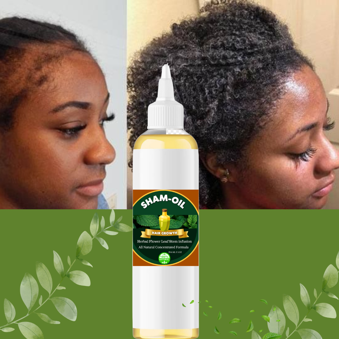 5.0z SHAM HAIR GROWTH OIL – Shamapromo.com