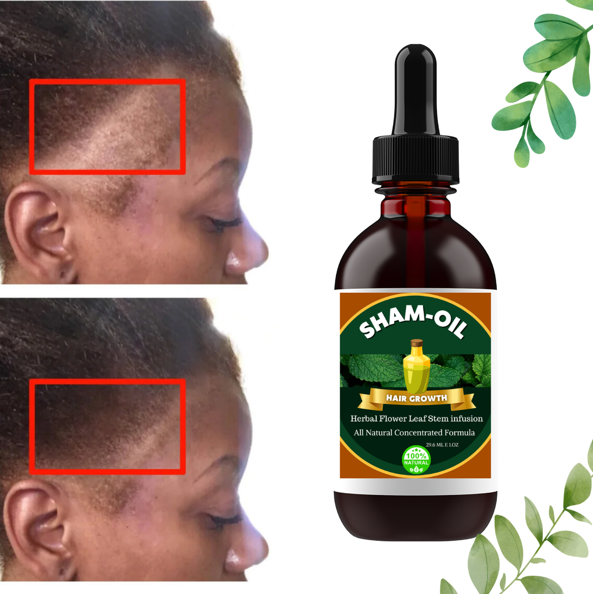 SHAM HERBAL LEAF HAIR GROWTH OIL – Shamapromo.com